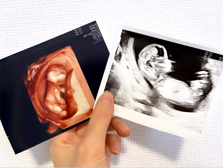 4Dエコーとは？いつからできる？メリットや2D・3Dエコーとの違いも解説 | 産婦人科「札幌みらいクリニック」